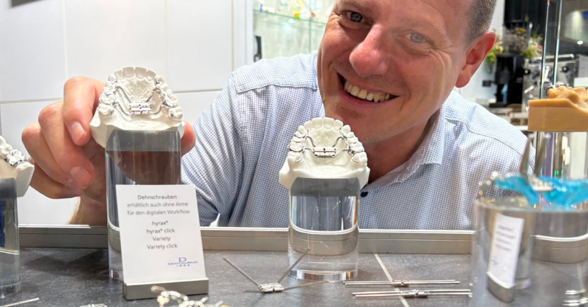 Dentaurum RPE Screws: Reliable, Safe Palatal Expansion with a Proven System