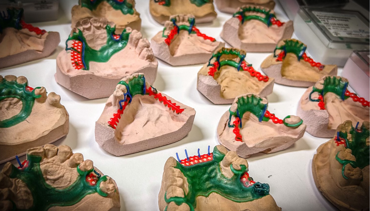 A never-ending pursuit of the perfect quality cast partial dentures