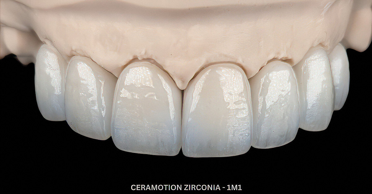 A better Zirconia. ceraMotion® Z in practice with Karim, Fabdent